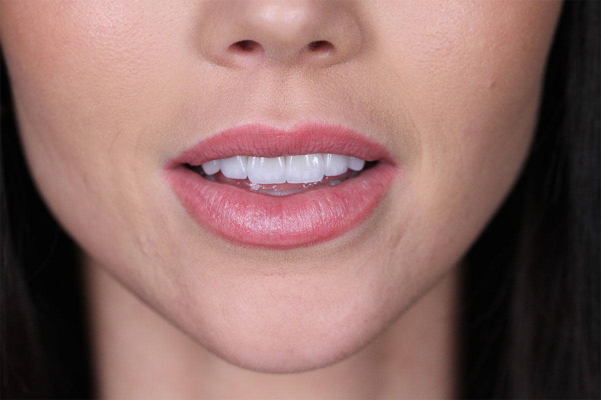 Ridge Reconstruction in Encino, CA | BioDental